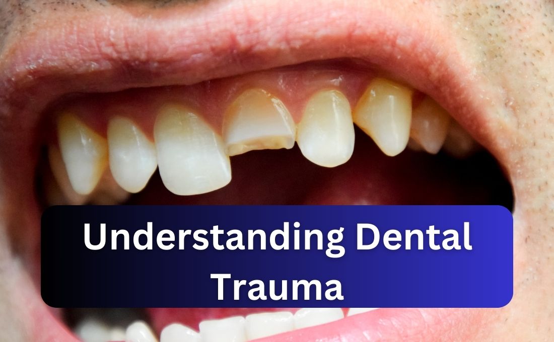 Have You Experienced Dental Trauma - Middletown New Jersey Dentist